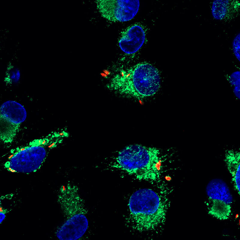Inflammation Signaling Pathways | Schlesinger Lab